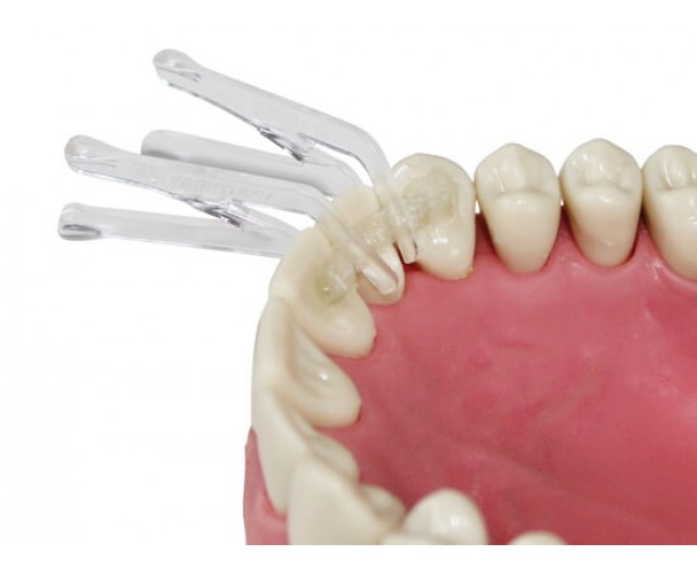 Fiber Splint Multi-Layer - Aparatologia Auxiliar Ortodoncia - Materiales de Ortodoncia